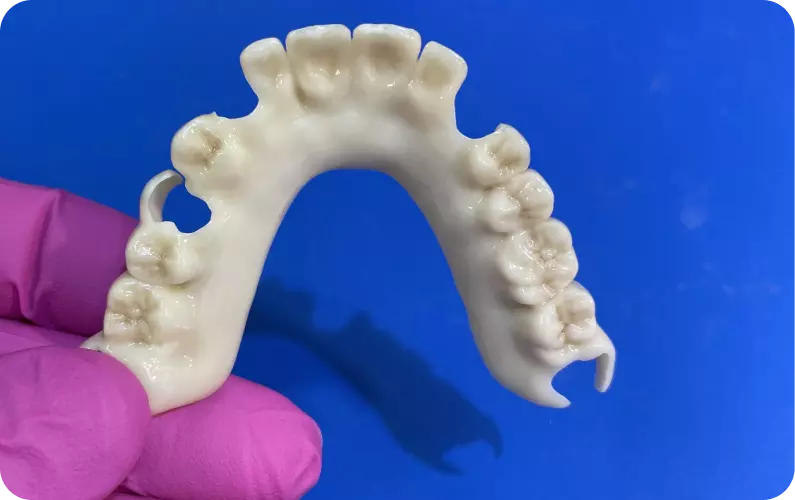 Nylon Flexible Partial Dentures | Denture Clinic Kedron