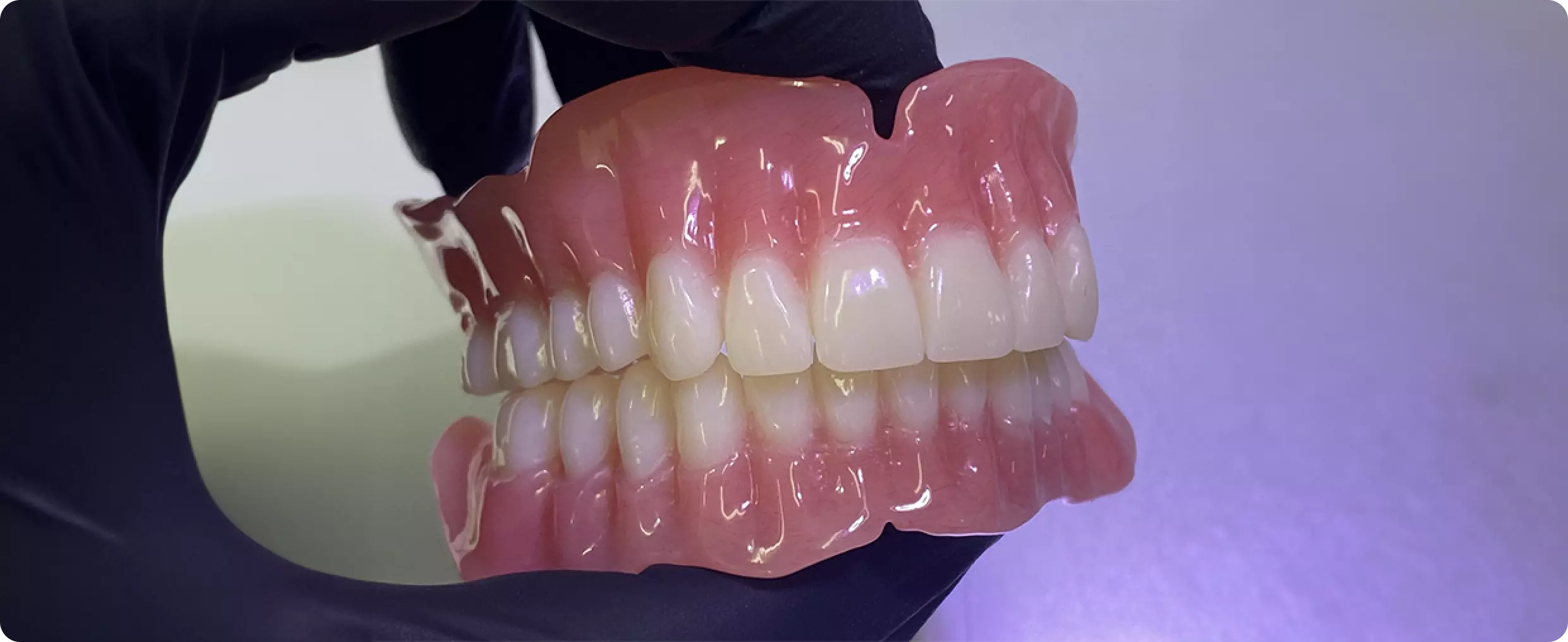 Types Of Partial Dentures Denture Clinic Kedron